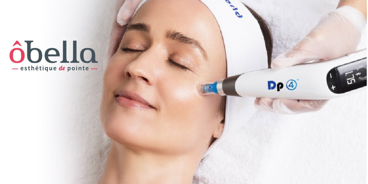 Microaiguillage DP4 - Obella esthétique de pointe